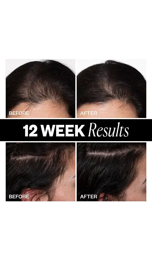 IGK Sponsored Hair Density Scalp Treatment - N,a