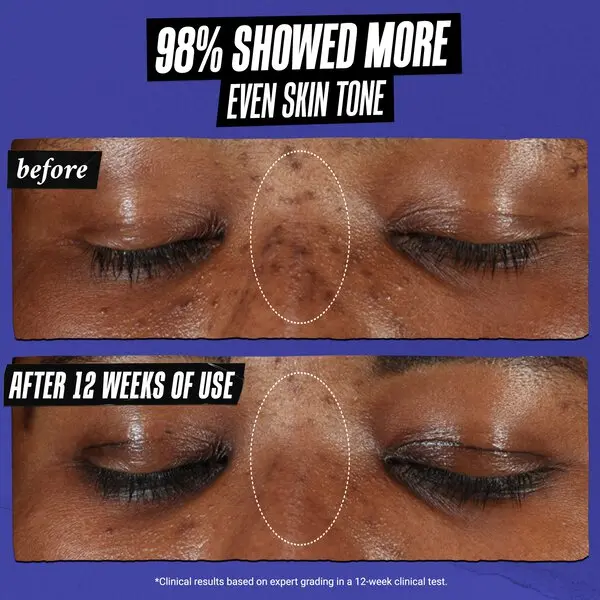 KIEHL'S SINCE 1851 Clearly Corrective™ Clarify & Brighten Dark Spot Serum - One-color