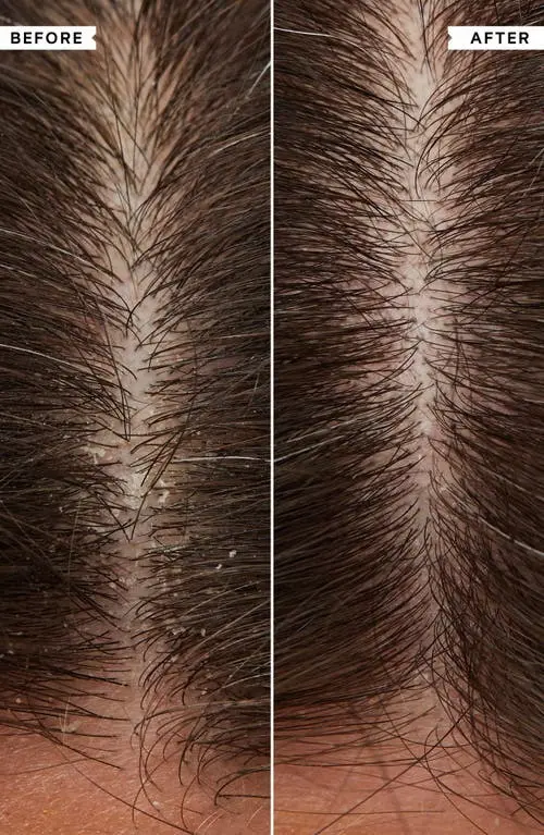 PHILIP KINGSLEY Flaky Scalp Calming Scalp Mask