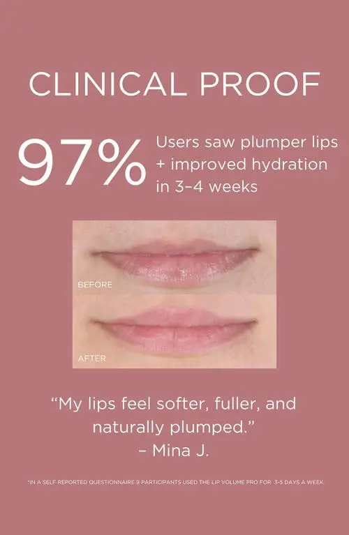 SOLARIS LABORATORIES NY Led Lip Volume Pro Red Light Device For Plump Lips - White