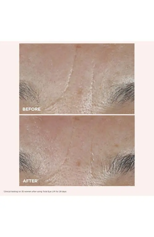 Clarins Total Eye Lift Refillable Eye Cream For Firming, Wrinkles - Refill