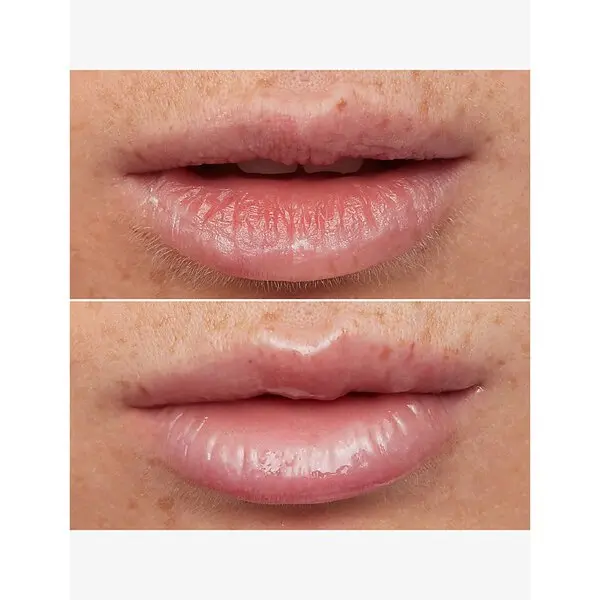 WONDERSKIN Lip Rehab Serum Oil 3.57ml - Clear
