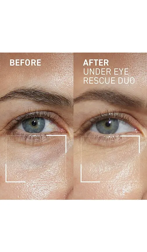 DR. BRANDT SKINCARE Eye Rescue Duo