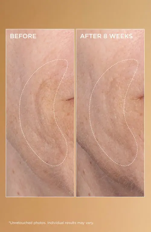 PERRICONE MD Neuropeptide Rejuvenating Moisturizer Broad Spectrum Spf 25