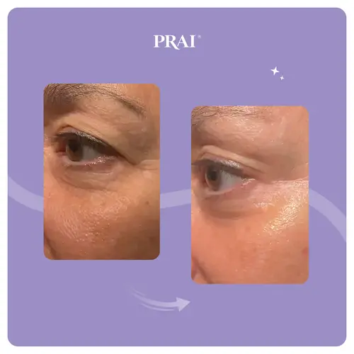 PRAI BEAUTY Ageless Eye Tight Uplift Serum 15ml
