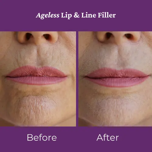 PRAI BEAUTY Ageless Lip Line Filler 8ml