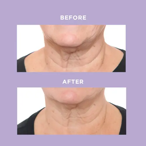 PRAI BEAUTY Ageless Throat & Decolletage Creme 50ml - None