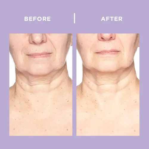 PRAI BEAUTY Ageless Throat & Decolletage Creme 50ml - None