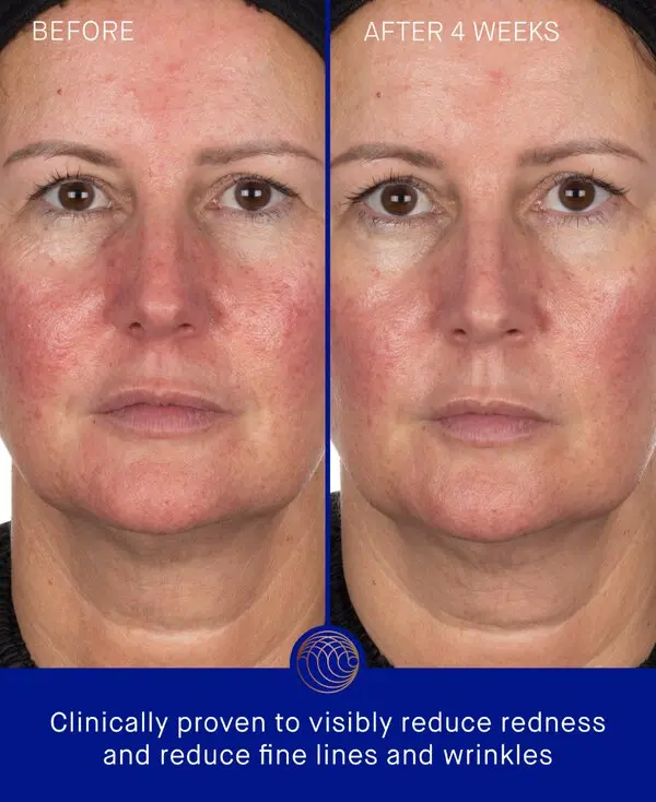 Augustinus Bader The Hydrogel Face Mask