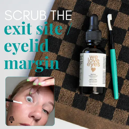 WE LOVE EYES Mgd & Chalazion Cleansing System