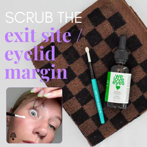 WE LOVE EYES Mgd & Chalazion Systemno Tea Tree Oil