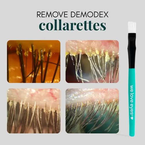 WE LOVE EYES Demodex Mites Debris Cleansing System