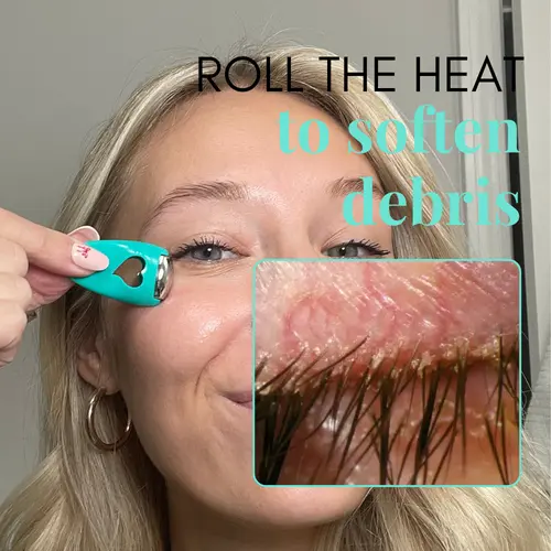 WE LOVE EYES Anterior Blepharitis Cleansing System