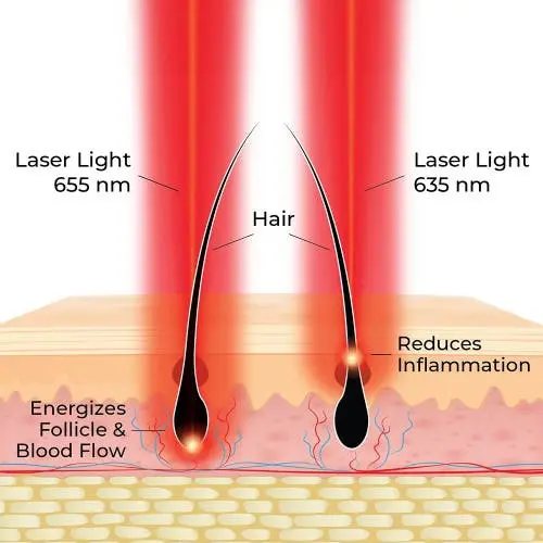 ACTONIS BY HAIRMAX Dual Action 18 Lasercomb