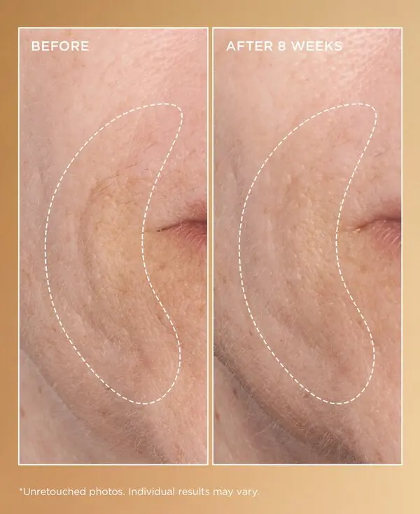 PERRICONE MD Neuropeptide Rejuvenating Moisturizer Broad Spectrum Spf 25