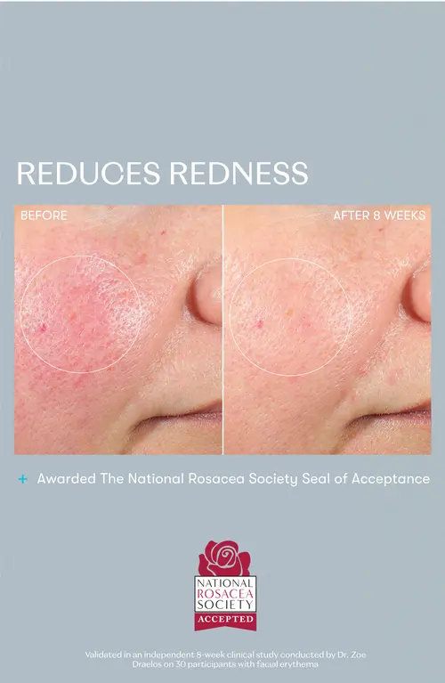 Rescuemd Dna Repair Complex For Redness & Scars