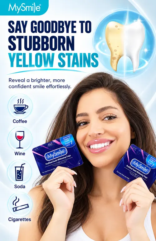 MYSMILE Prefilled Teeth Whitening Trays Kit - Purple