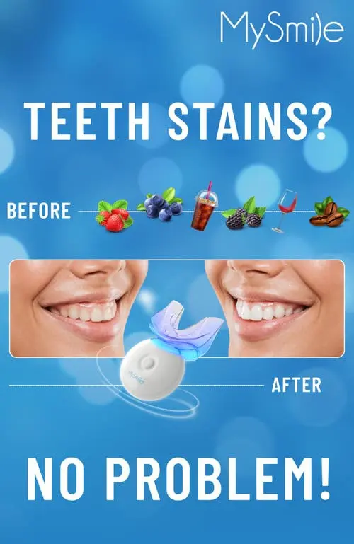 MYSMILE Original Teeth Ning Kit With 5 Led Light