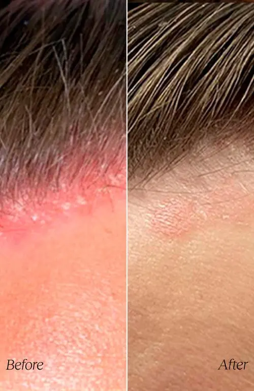MONPURE Clarifying Scalp Scrub 90g