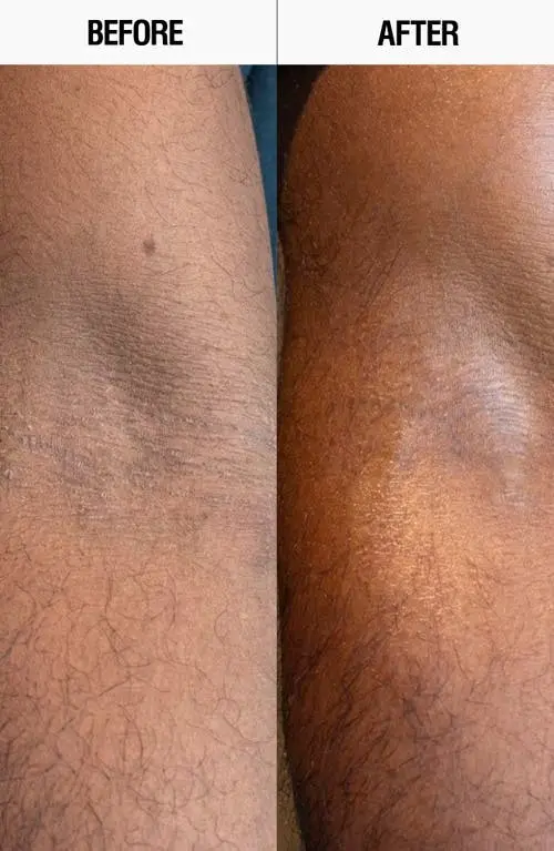 GROWN ALCHEMIST Resurfacing Targeted Body Lotion - No Color