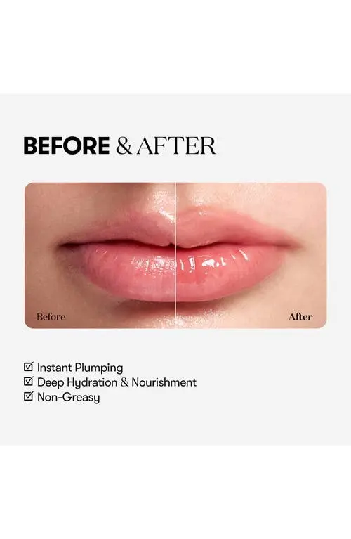 VT COSMETICS Reedle Shot Lip Plumper Beginner - Silver