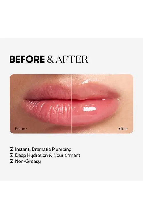 VT COSMETICS Reedle Shot Lip Plumper Expert - Silver