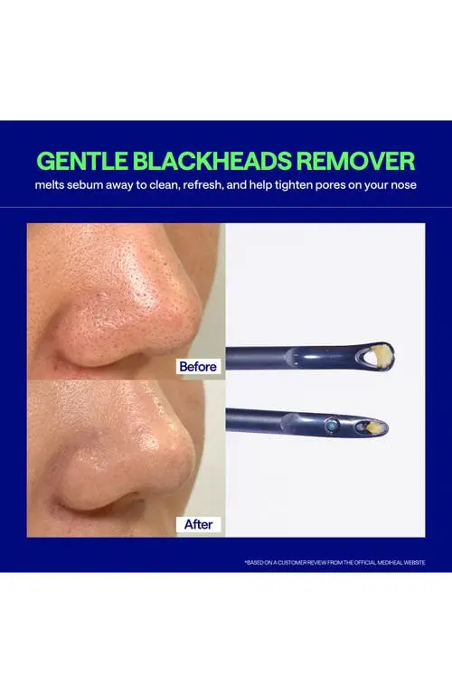 MEDIHEAL Blackhead Melting Clear Nose Patch - Navy
