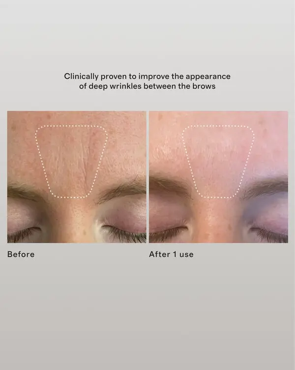 Quince 111skin Wrinkle Erasing Retinol Patches, Skincare
