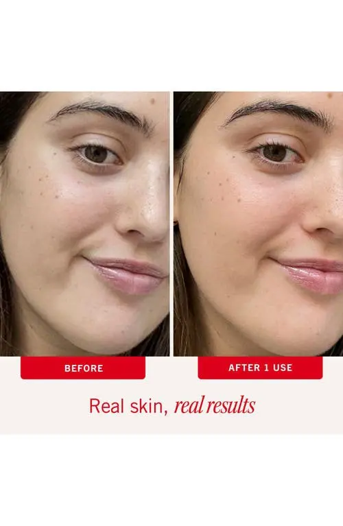FIRST AID BEAUTY Ultra Repair Face Lotion - No Color