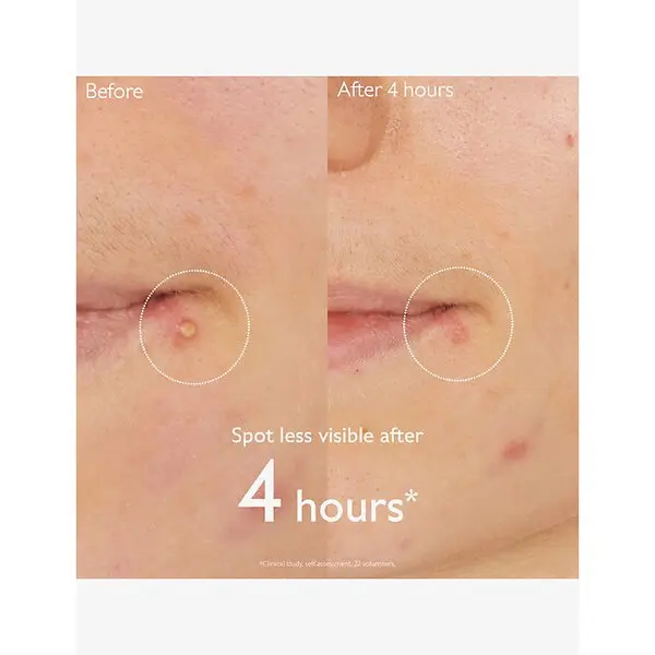 CAUDALIE Vinopure Acid Salicylic Spot Solution