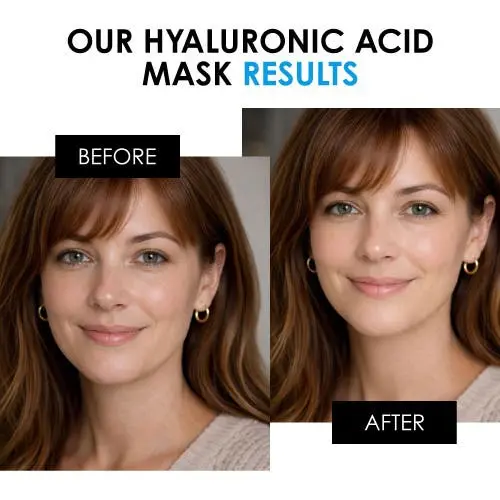 SKIN CHEMISTS Anti-aging Hyaluronic Acid Mask 50ml For Dryness