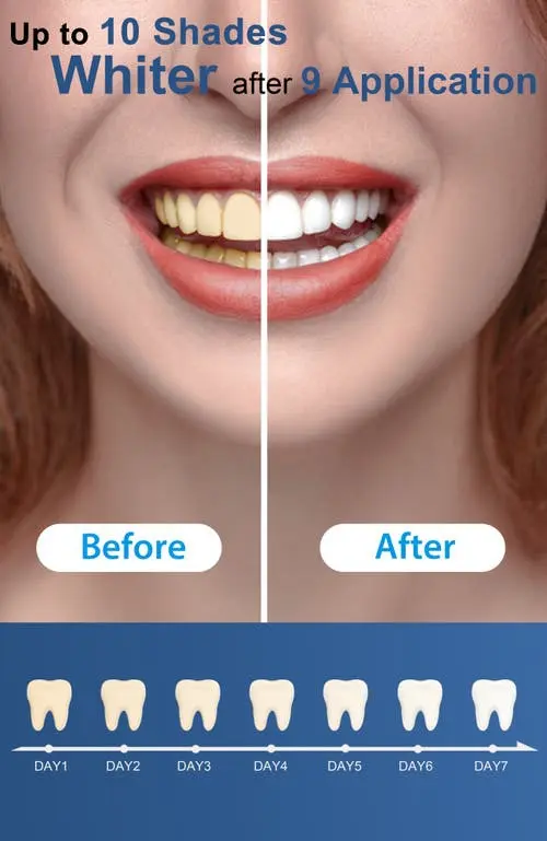 MYSMILE Teeth Whitening Gel Pack - Clear
