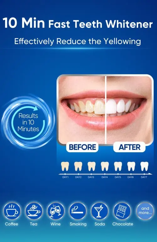 MYSMILE Teeth Whitening Kit With 28 Led Light - Deep Blue