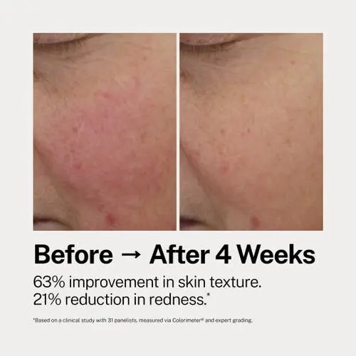 DR ROSSI DERM MD The Catalyst Renewing Serum - 30ml