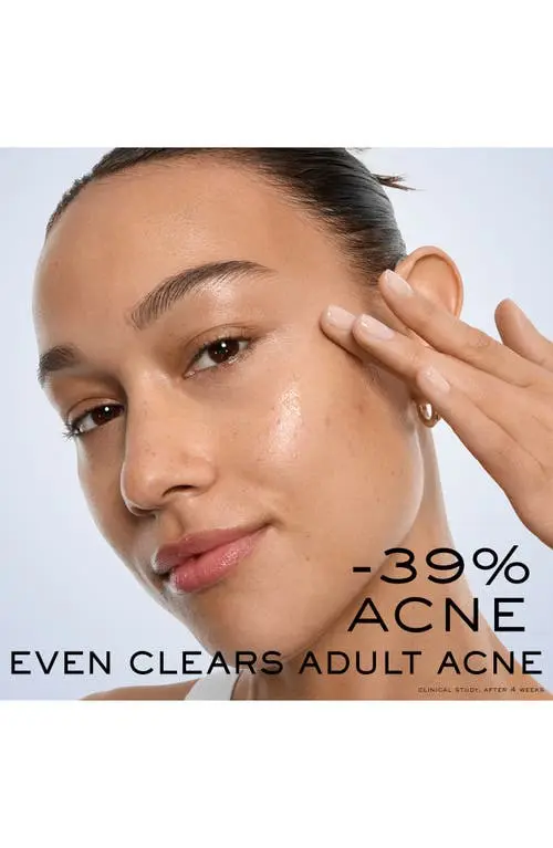 LANCOME Clarifique Bx-interceptor Acne Treatment With Glycolic & Salicylic Acid - No Color