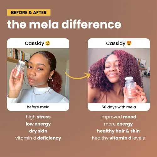 MELA VITAMINS Glow Up Bundle For Of Color
