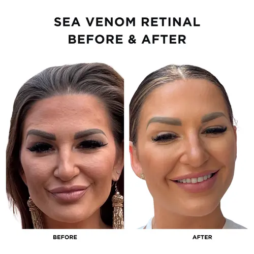 INTOXICATED COSMETICS Sea Venom Retinal | 1fl.oz/30ml | Anti-aging Time Released Retinaldehyde | Regenerating Sensamone P5 | Restructuring
