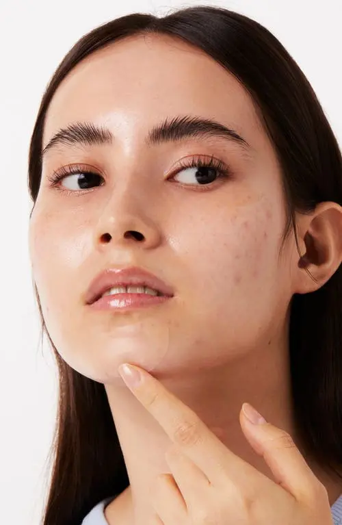 I DEW CARE Timeout Blemish Patch Chin & Cheeks