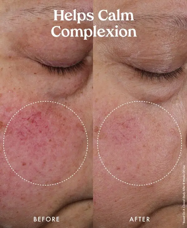 KOPARI BEAUTY Nourishing Hydro-lipid Barrier Serum