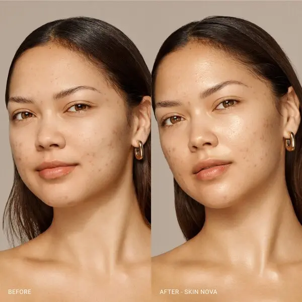 VIEVE Skin Nova 30ml
