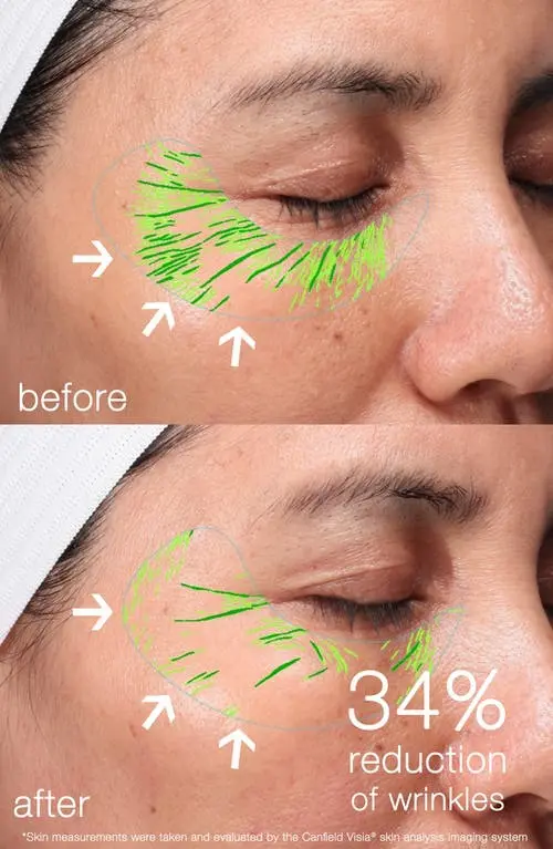 BIO-THERAPEUTIC Bt-sculpt Gen2 Microcurrent Sculpting