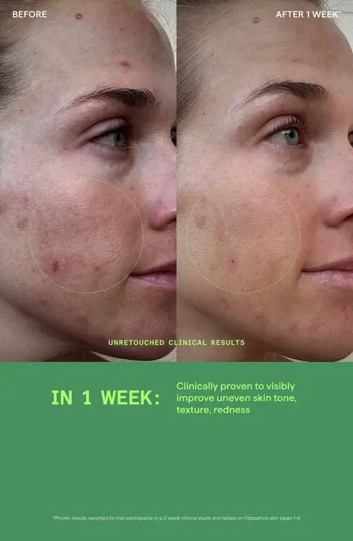 MURAD Biome-balancing Calm & Recover Cream