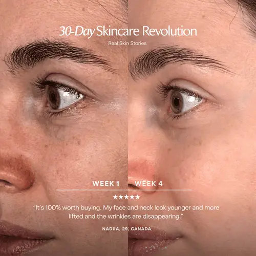 PROJECT E BEAUTY Lumalux Face Pro Led Light Therapy Mask