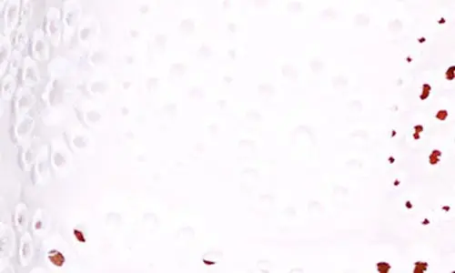 Susana Monaco Embroidered Eyelet Shorts