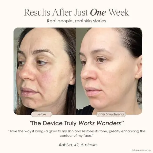 PROJECT E BEAUTY Reva Instant Age Renewal Wand
