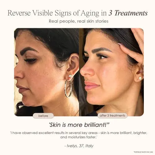 PROJECT E BEAUTY Reva Instant Age Renewal Wand
