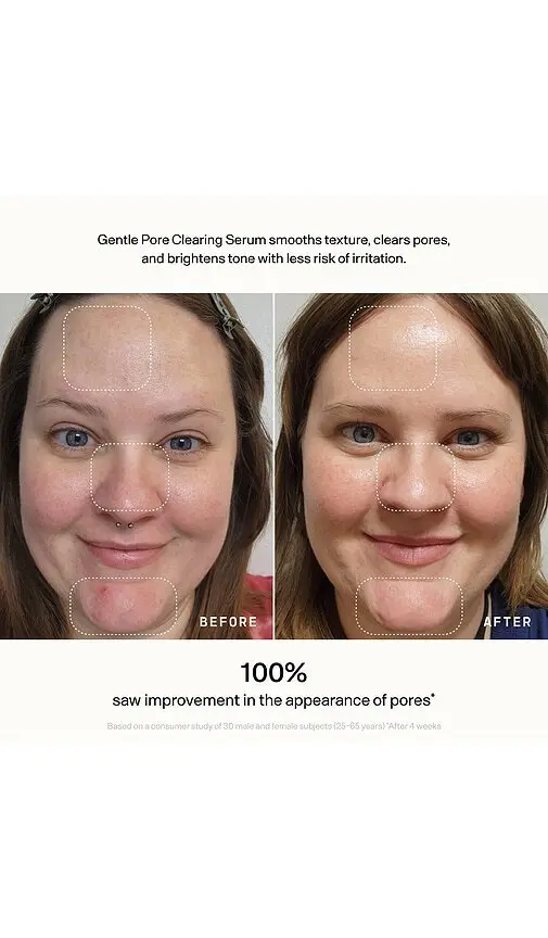 VERSED Skin Refine Gentle Pore Clearing Serum