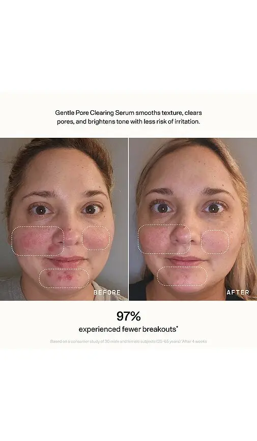 VERSED Skin Refine Gentle Pore Clearing Serum