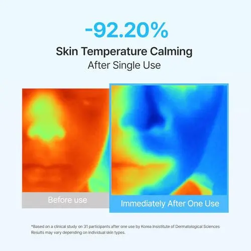 CANDORLOV Face Mask Hyaluronic Acid Icy Puff Cooling Soothing De Puffing 10 Pack