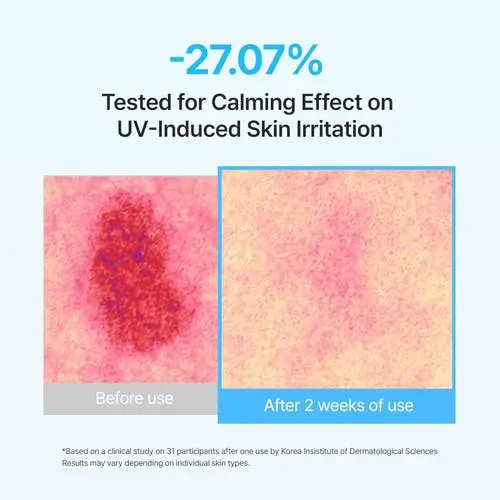 CANDORLOV Face Mask Hyaluronic Acid Icy Puff Cooling Soothing De Puffing 10 Pack